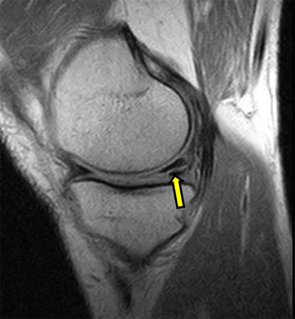 Images and Videos, Magnetic Resonance Imaging (MRI) - Knee image (knee ...